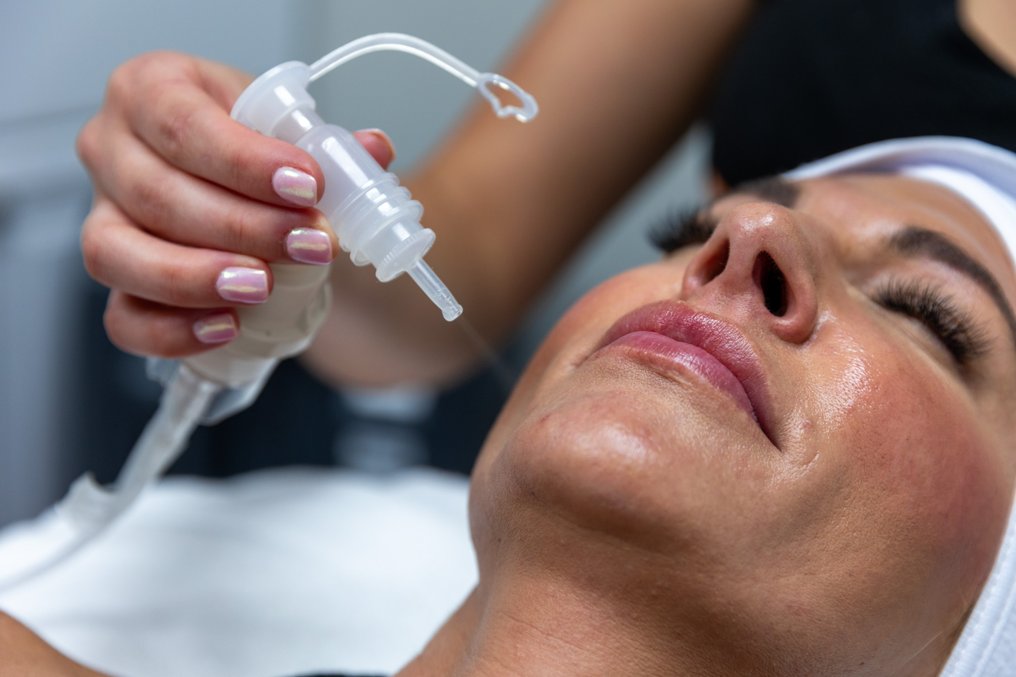 Acne Therapy | Regain Functional Medicine and Aesthetics