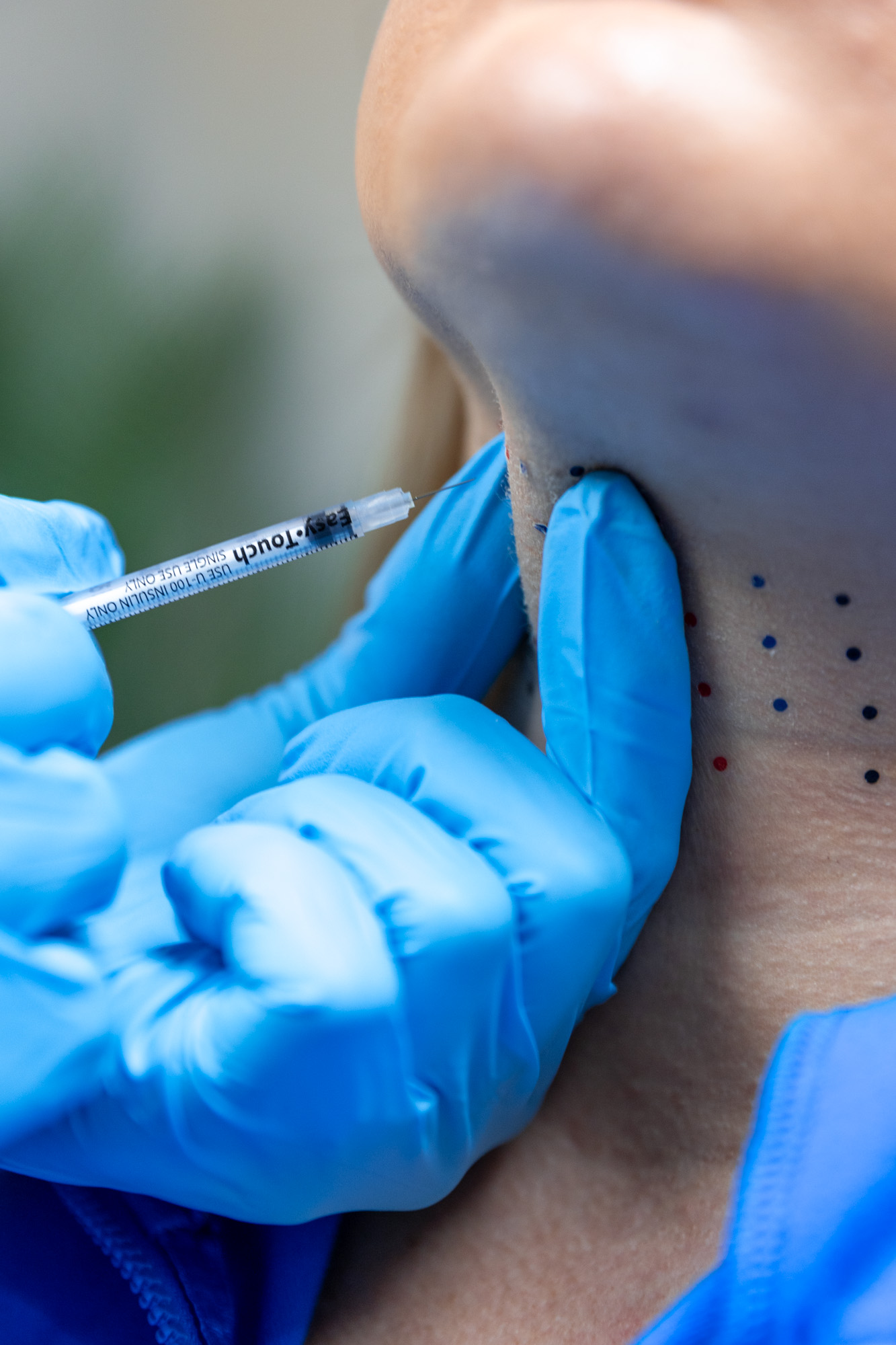 Kybella | Regain Functional Medicine and Aesthetics