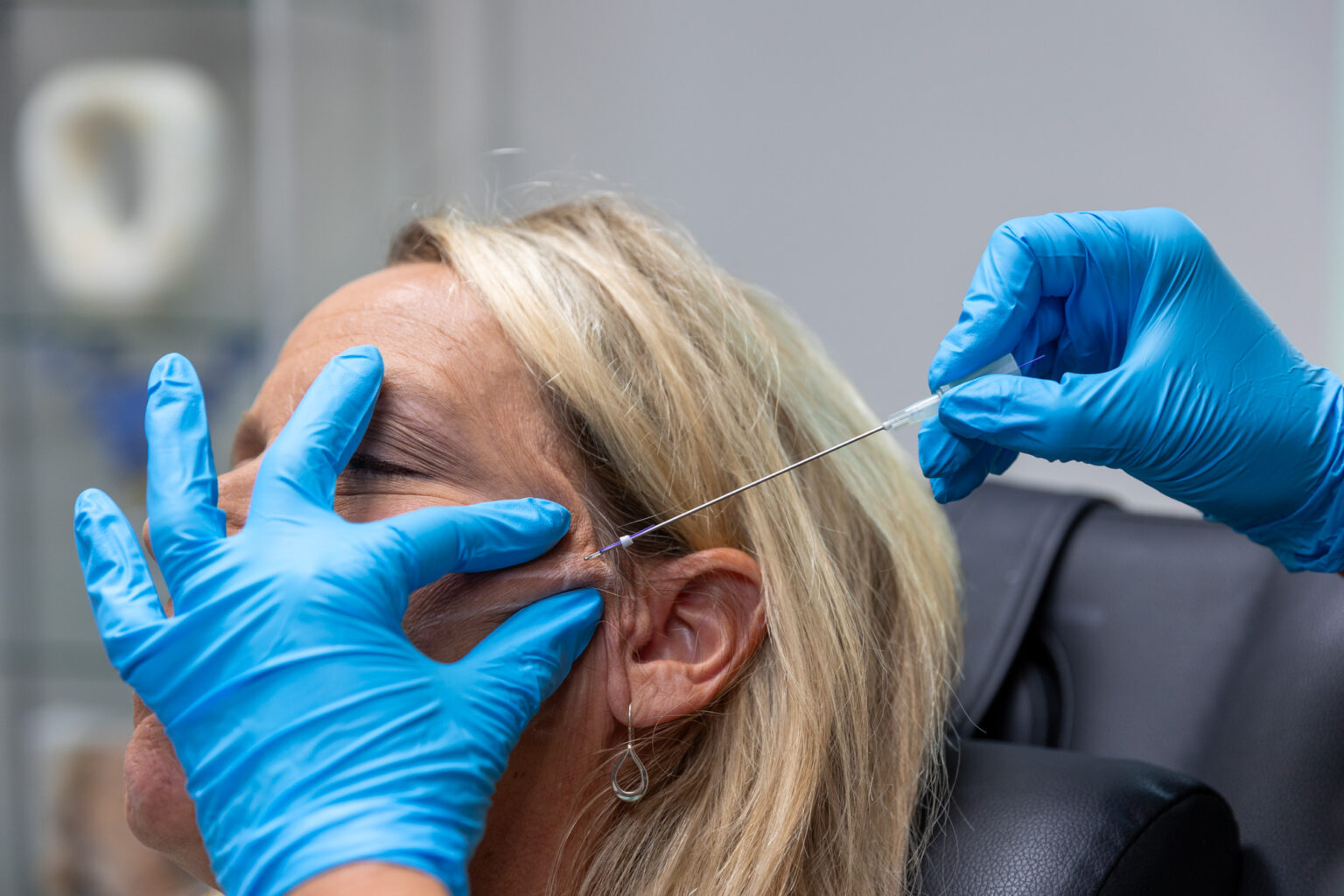 PDO Threads | Regain Functional Medicine and Aesthetics