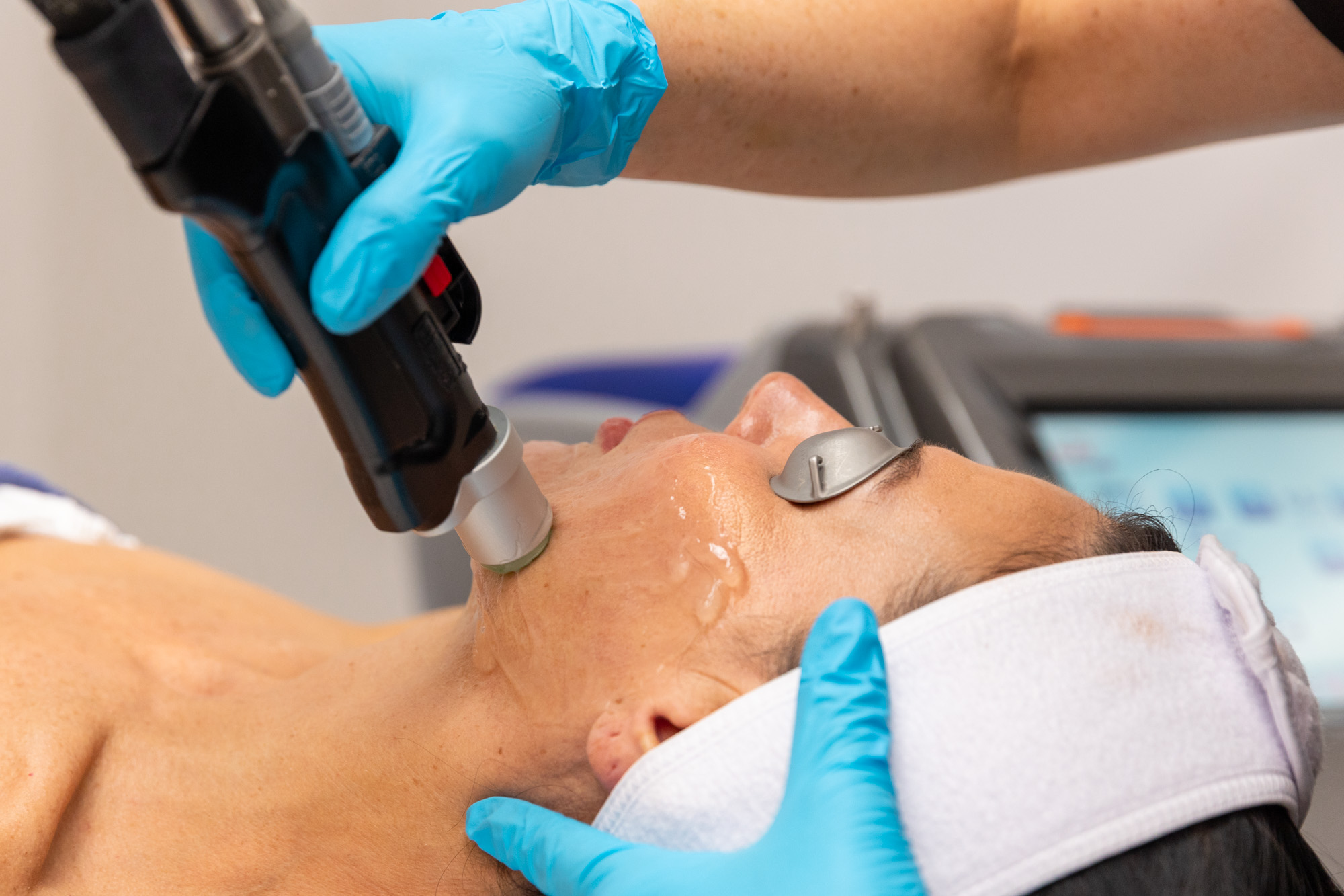 Laser Hair Removal in Leawood | Regain